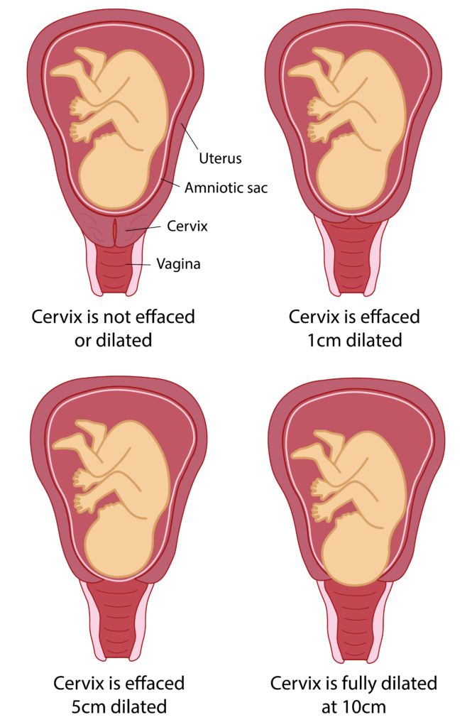 Cervix In Early Pregnancy Pictures: A Comprehensive Guide - Mammy Cares