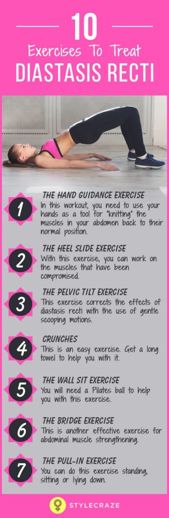 Effective Exercises for Rectus Diastasis: A Guide to Strengthening and ...