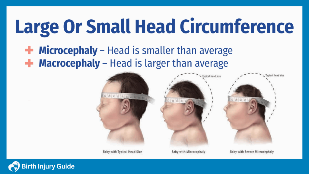 How Big Is A Baby's Head At Birth: A Comprehensive Guide - Mammy Cares