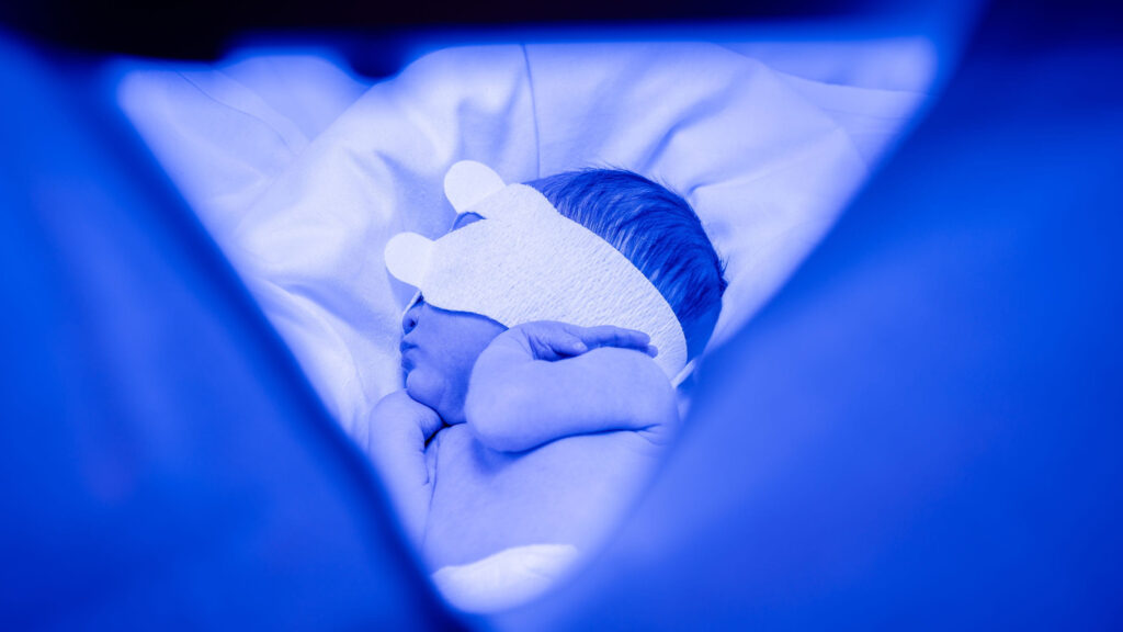 How To Put Baby In Sunlight For Jaundice - Mammy Cares